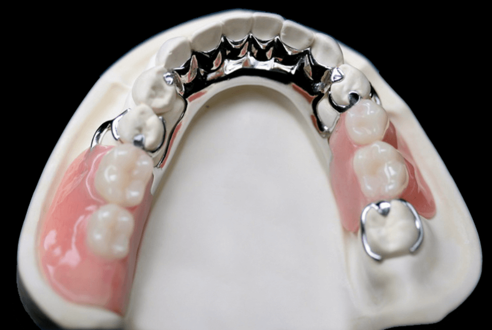 Partial Denture In Toronto Atlas Dental